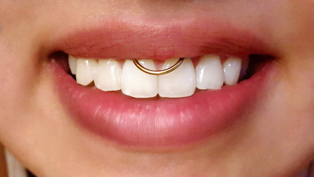 Tipos de Piercing, Onde colocar (Lugares do corpo)